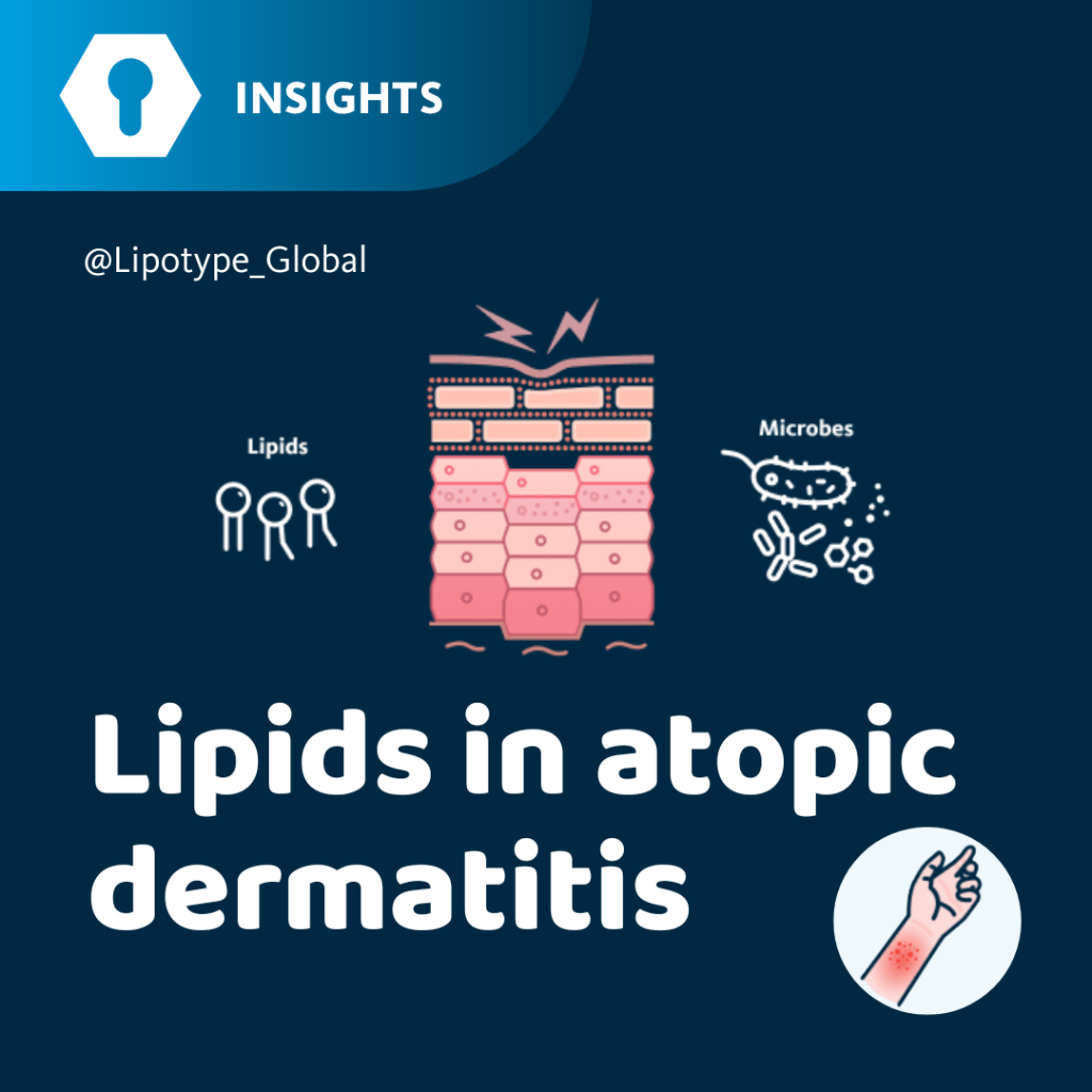 Lipidomics by Lipotype